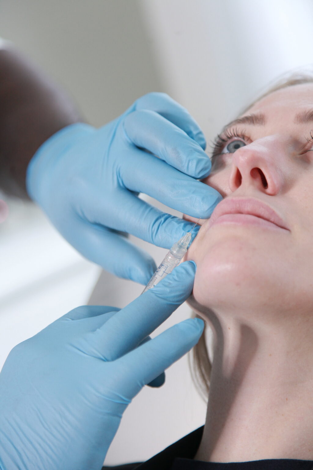 What filler, what area Pt 2 - Reversible and non reversible fillers ...